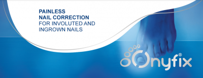 Onyfix Nail Correction | Pain-Free Ingrown Toenail Fix