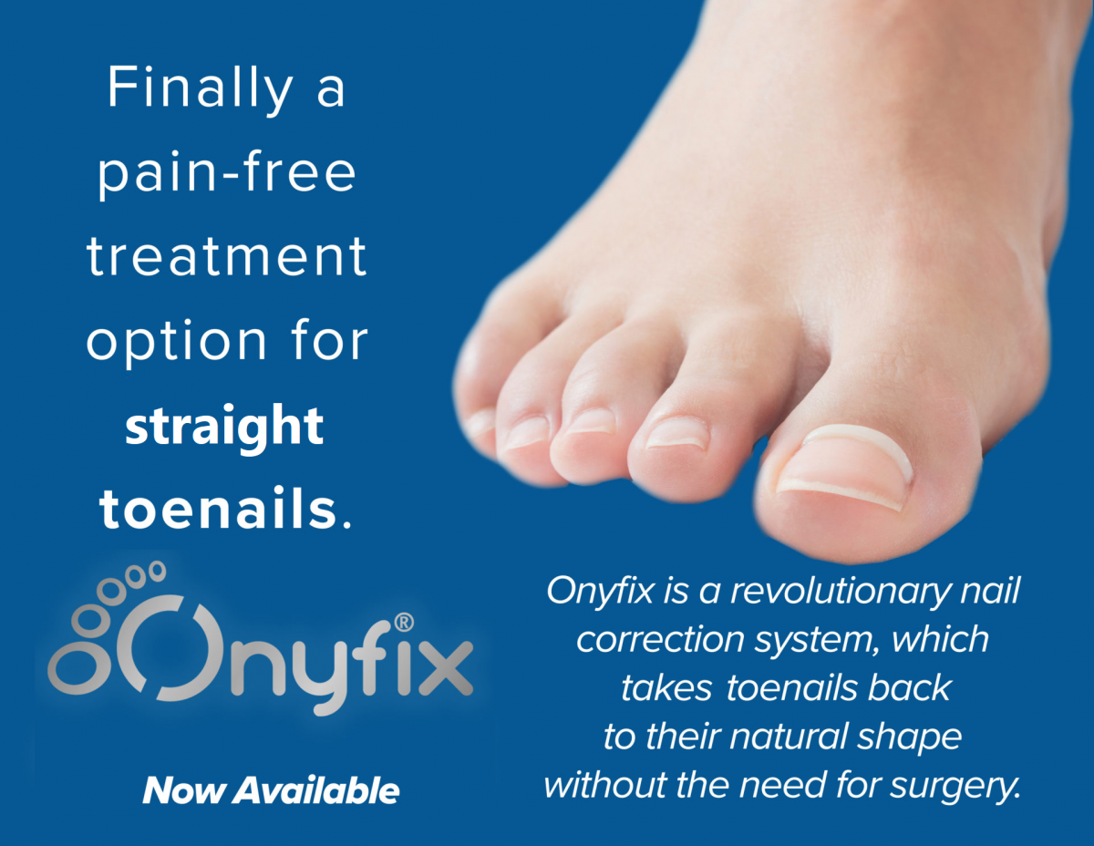 Onyfix Nail Correction | Pain-Free Ingrown Toenail Fix